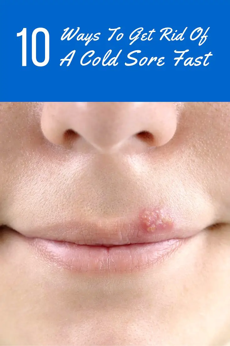 10 Ways To Get Rid Of A Cold Sore Fast Shtf Prepping And Homesteading