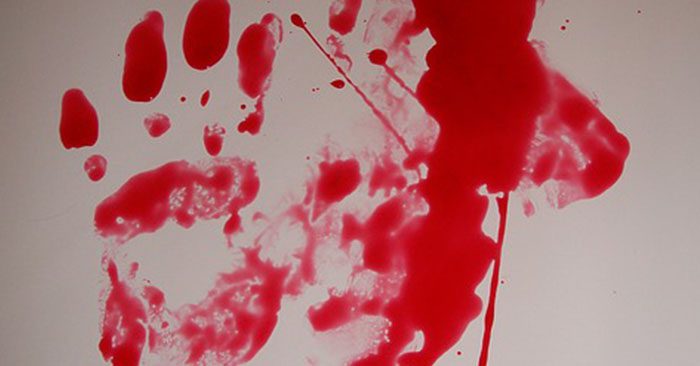 4 Tips To Stop Someone From Bleeding To Death